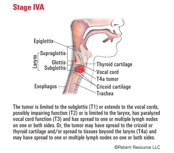 Head & Neck Laryngeal Cancer